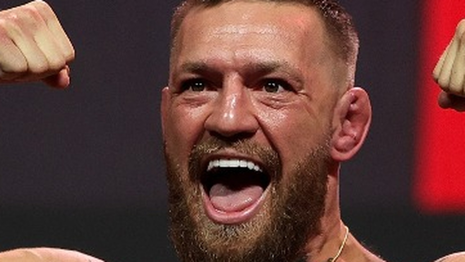 Conor McGregor's Leg Injury Explained