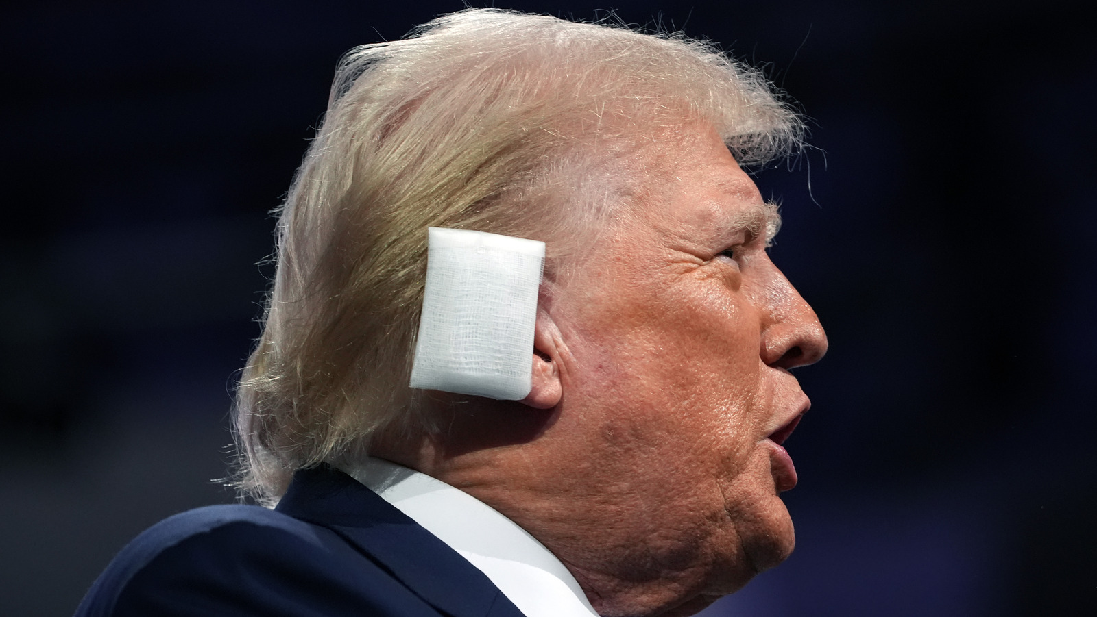 Could Donald Trump's Ear Injury Cause Lasting Damage? – onlyTrustedInfo.com