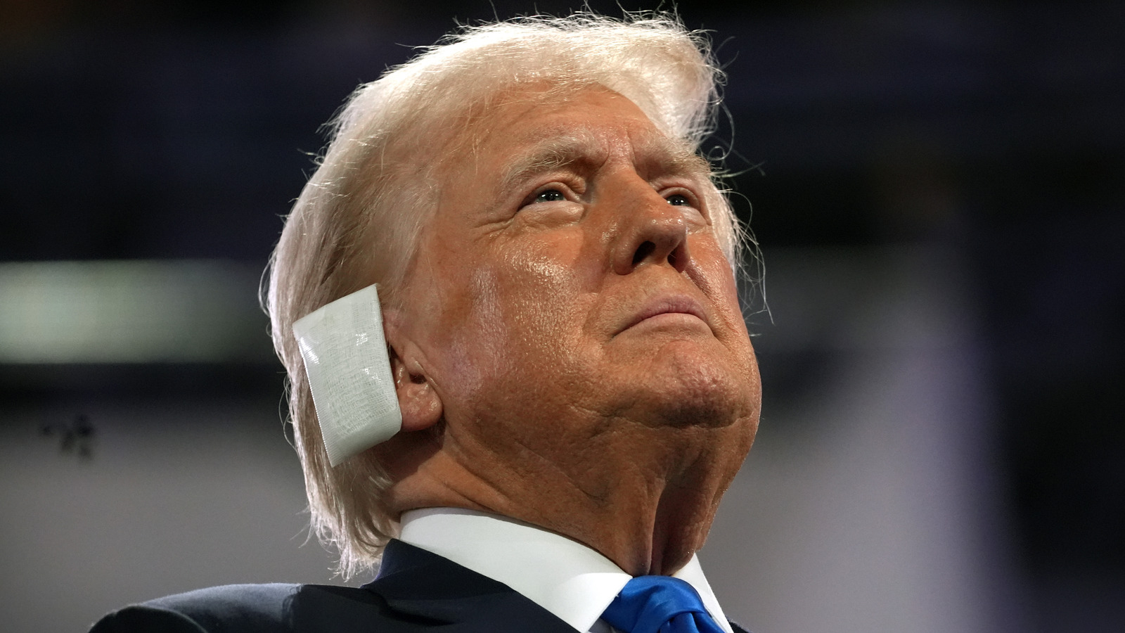 Donald Trump's Doctor Explains Why Ex-President's Bullet Wound Still ...