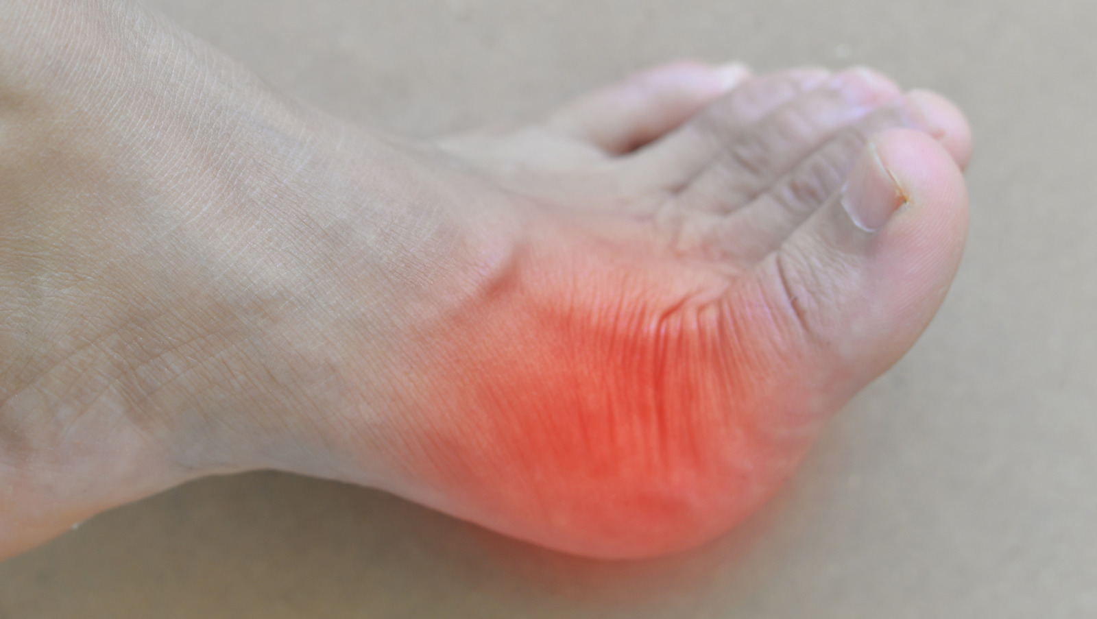 Gout Explained: Causes, Symptoms, And Treatments