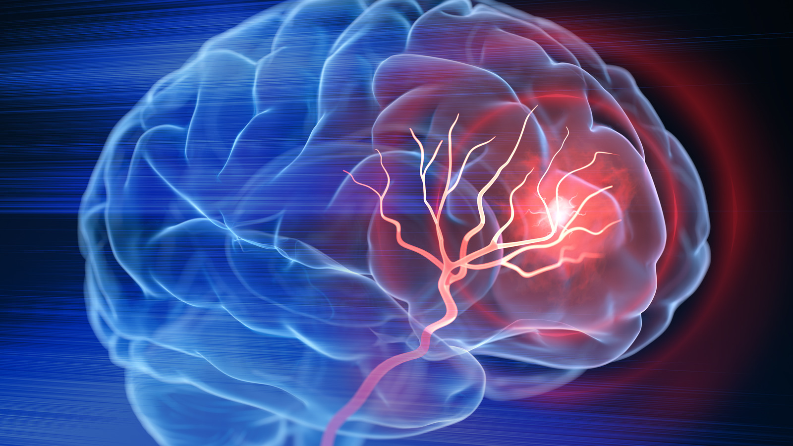 High Cortisol And Cushing's Syndrome: What's The Connection?