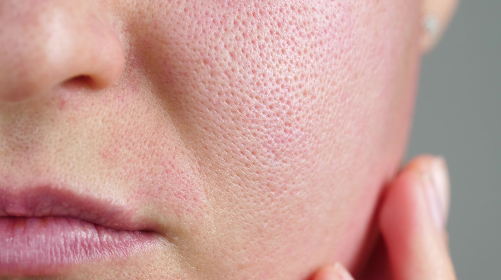 If Your Cheeks Are Always Red It Could Be A Sign Of This If Your Cheeks Are Always Red It Could Be A Sign Of This