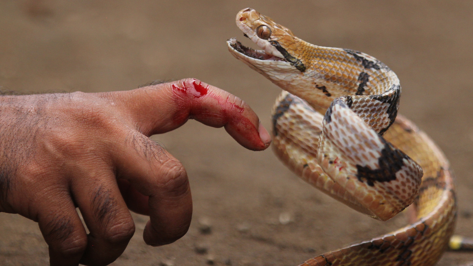 Is It Safe To Suck The Venom Out Of A Snake Bite 
