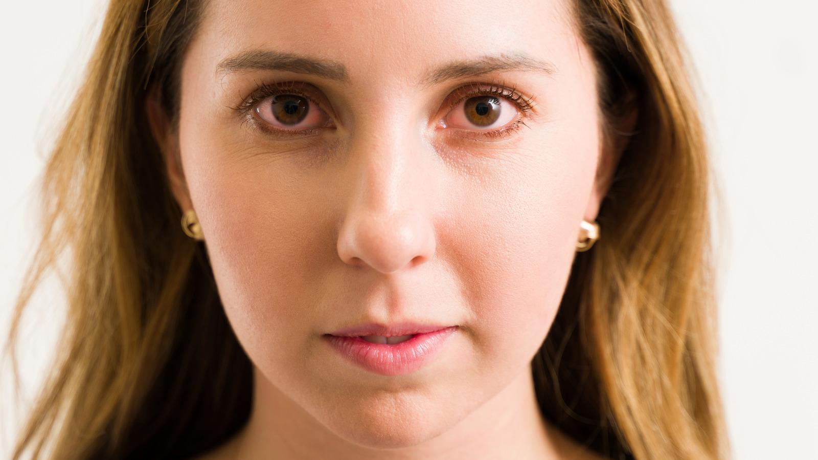 Pink Eye Explained: Causes, Symptoms, And Treatments