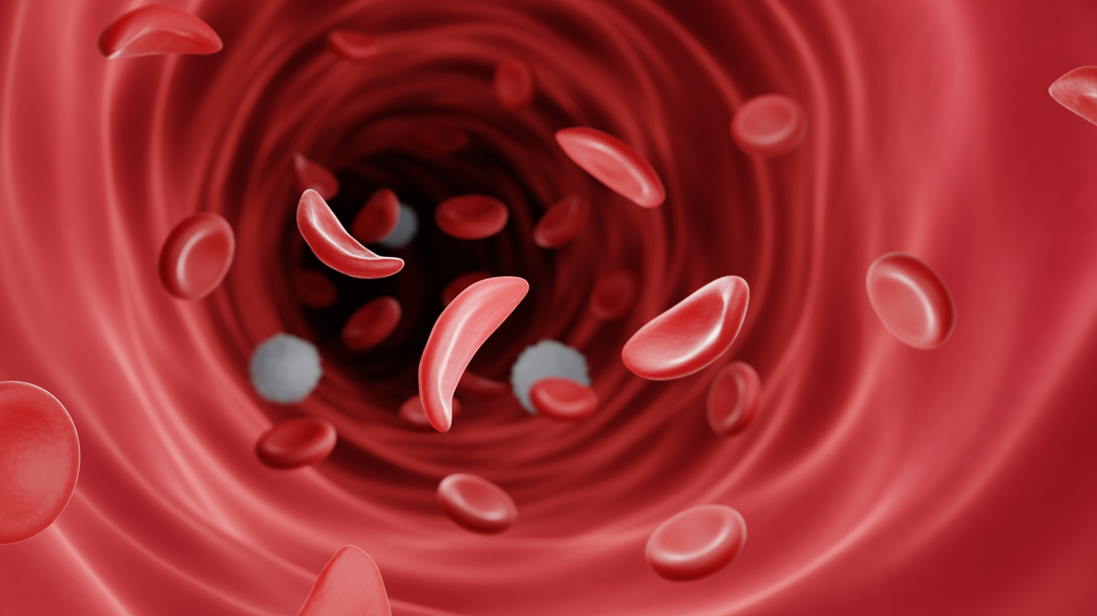 Sickle Cell Disease Explained Causes Symptoms And Treatments