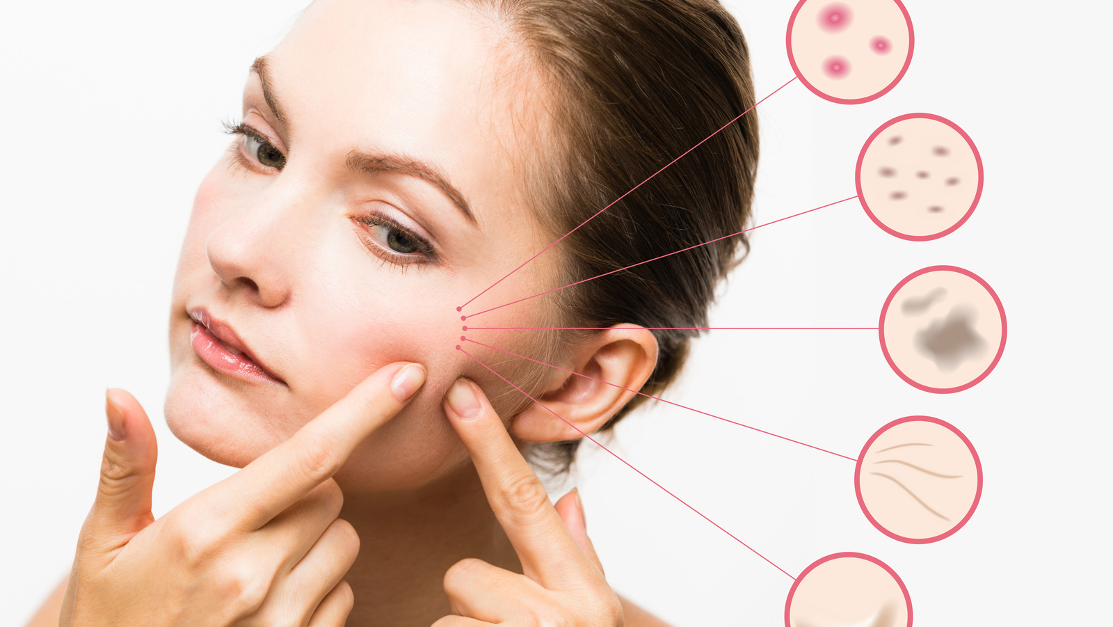 Skin Purging Vs. Breakouts: What's The Difference?