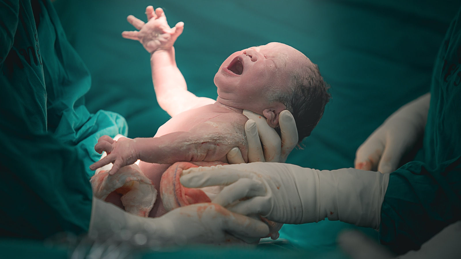 The Real Reason Why The Umbilical Cord Shouldn't Be Cut Immediately ...