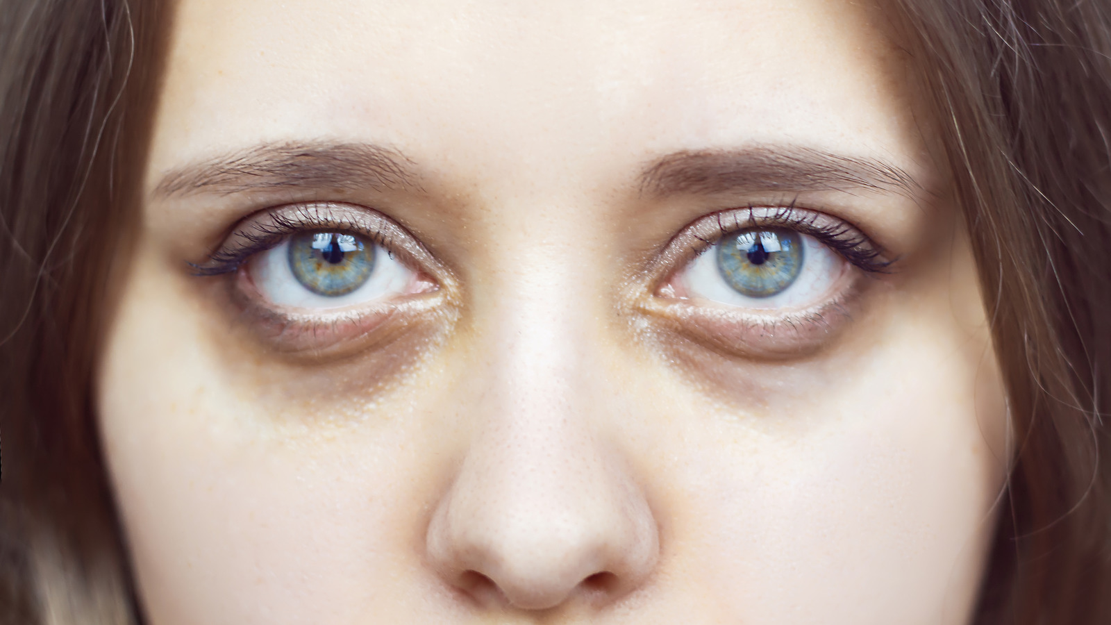 The Real Reason You Get Dark Circles Under Your Eyes The Real Reason You Get Dark Circles Under Your Eyes