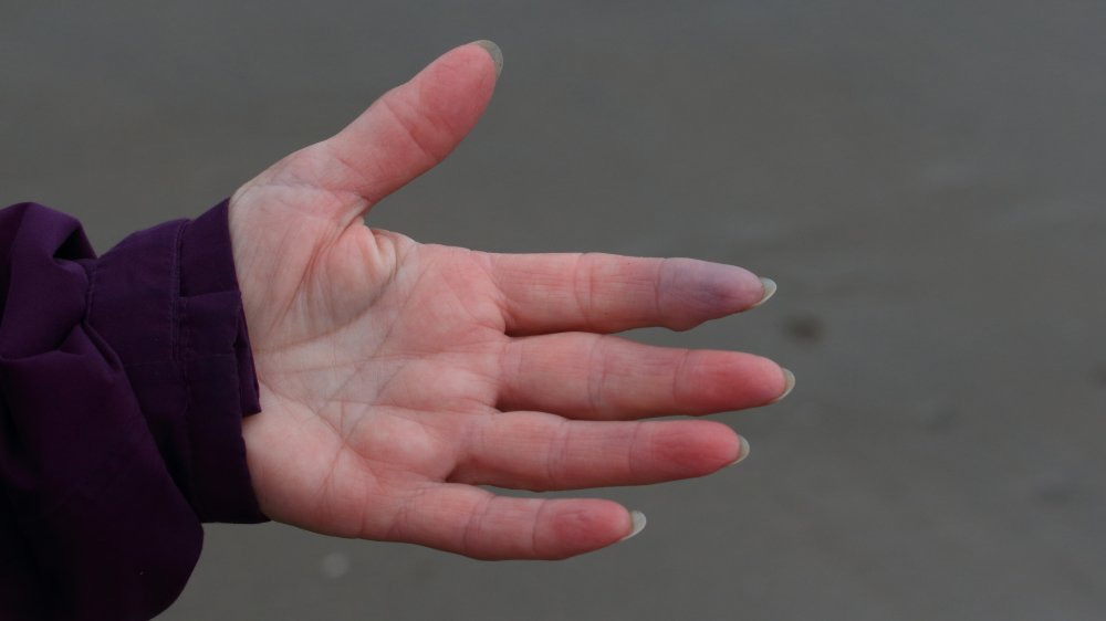 the-surprising-things-your-fingernails-can-tell-you-about-your-health