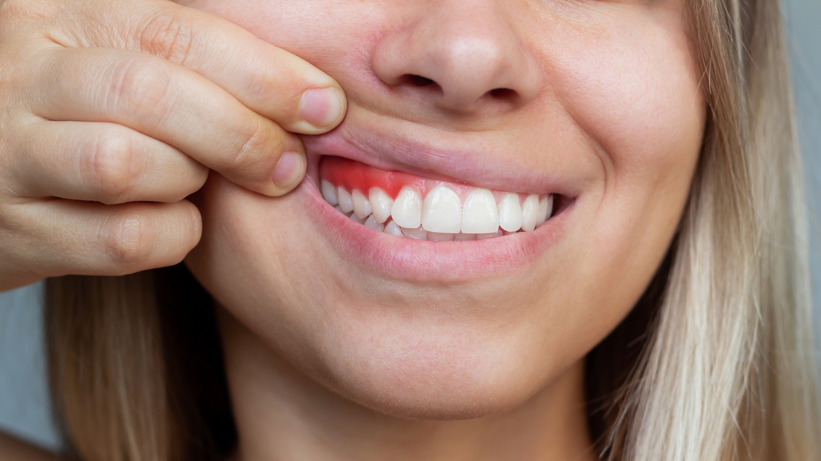 The Unexpected Link Between Obesity And Gum Disease
