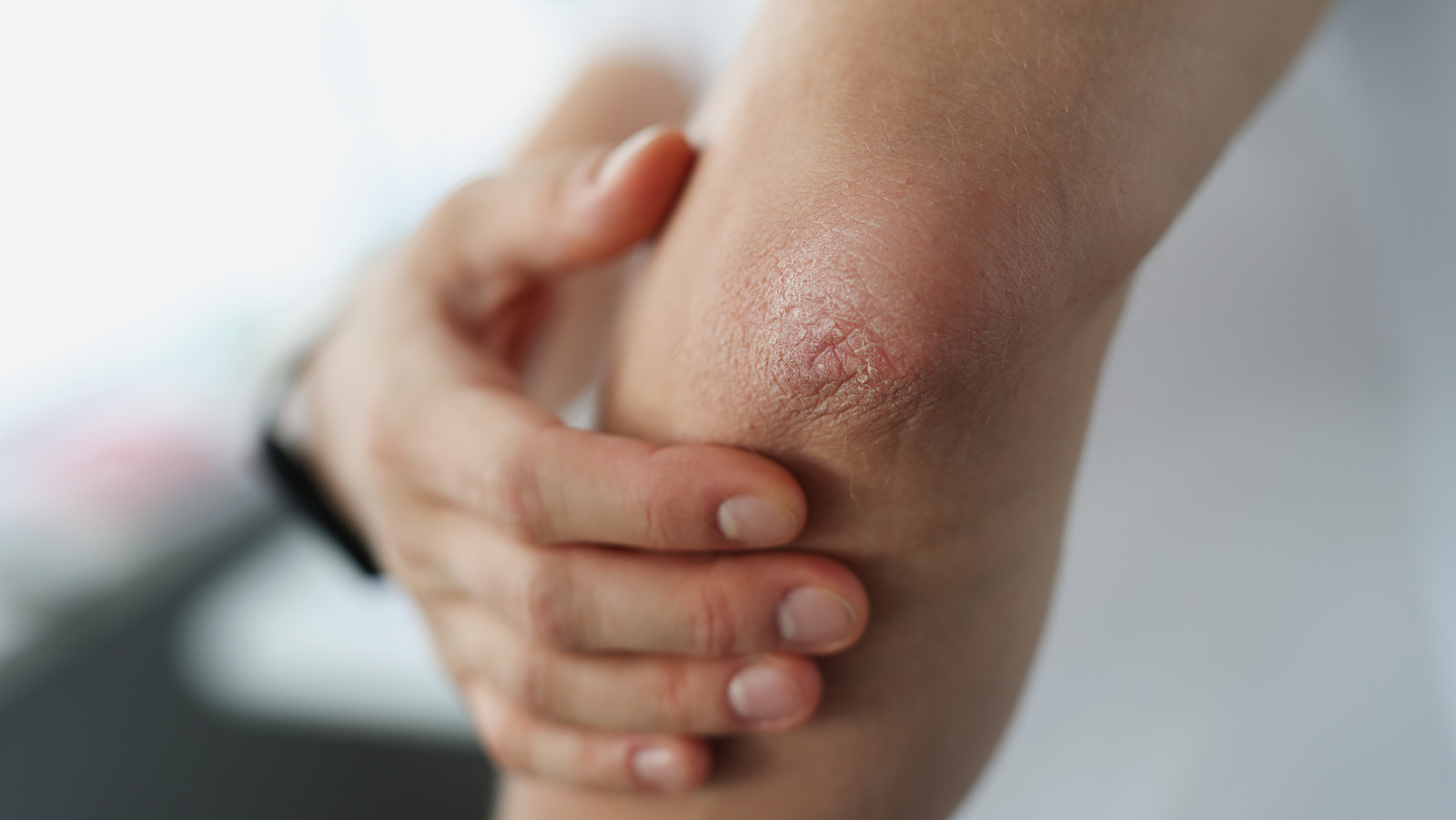 This Is What Really Causes Your Dry Elbows This Is What Really Causes Your Dry Elbows