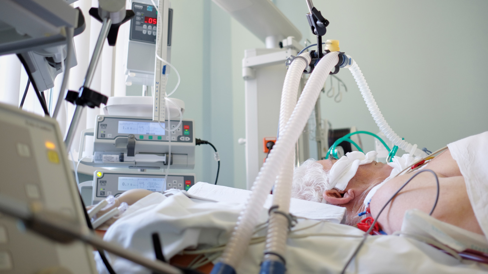 Ventilators: A Comprehensive Guide