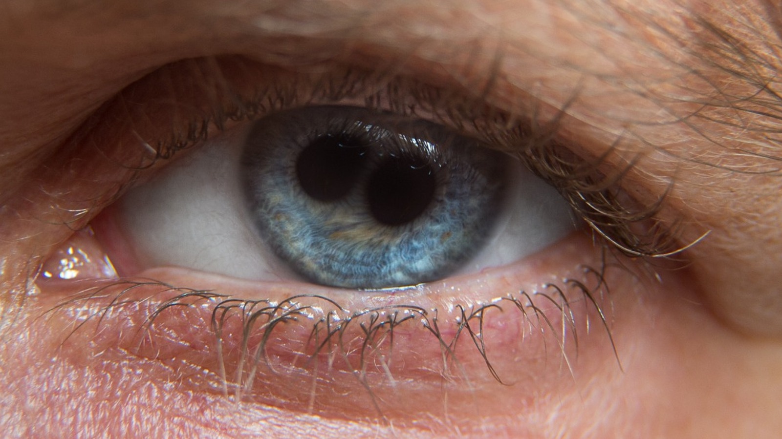 What Does It Mean If You Have Two Pupils In One Eye 
