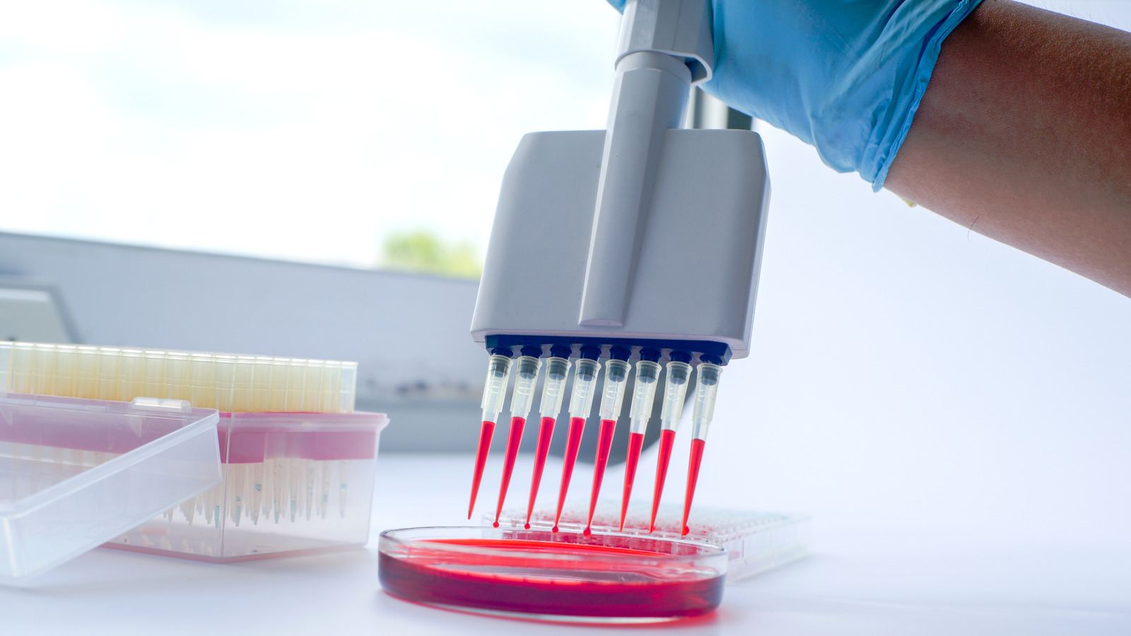 What Does It Mean When Your Blood Total Protein Is High 