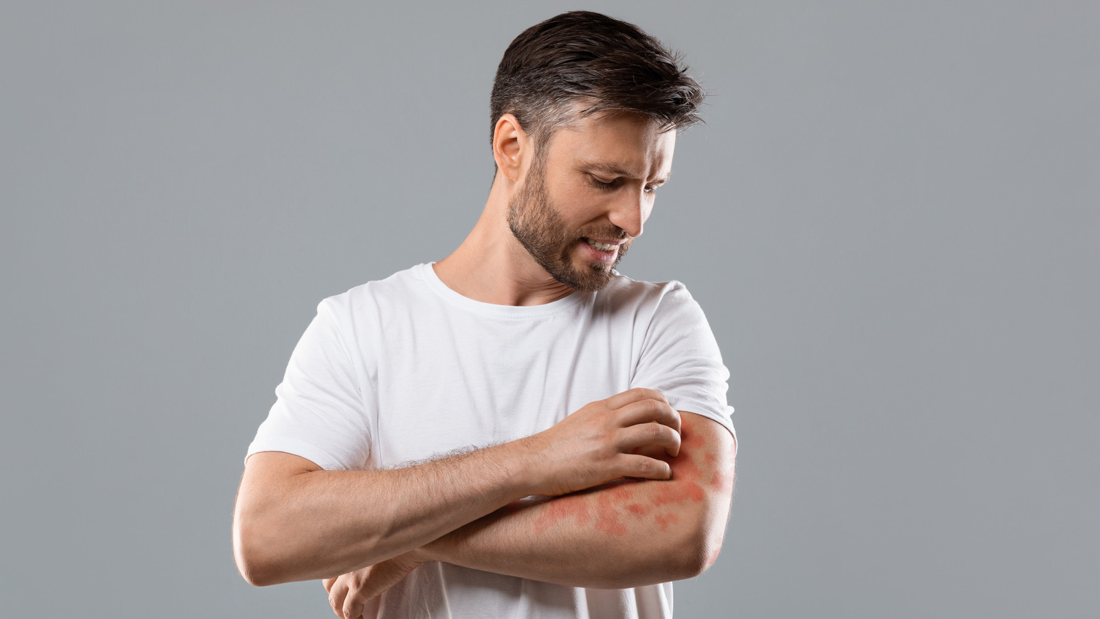 What's The Difference Between Psoriasis And Ringworm?